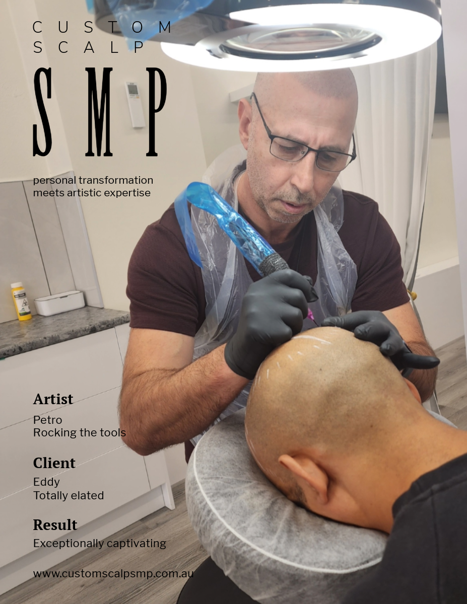 Custom Scalp SMP Scalp Micropigmentation Melbourne Suite 2/763 Centre ...