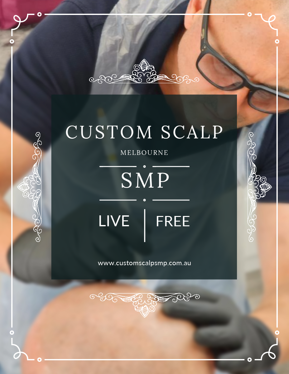 Custom Scalp SMP Scalp Micropigmentation Melbourne Suite 2/763 Centre ...